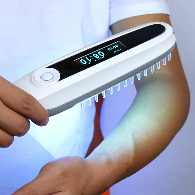 311nm UV lamps Phototherapy - Treatment Lamp - For Vitiligo Psoriasis ...