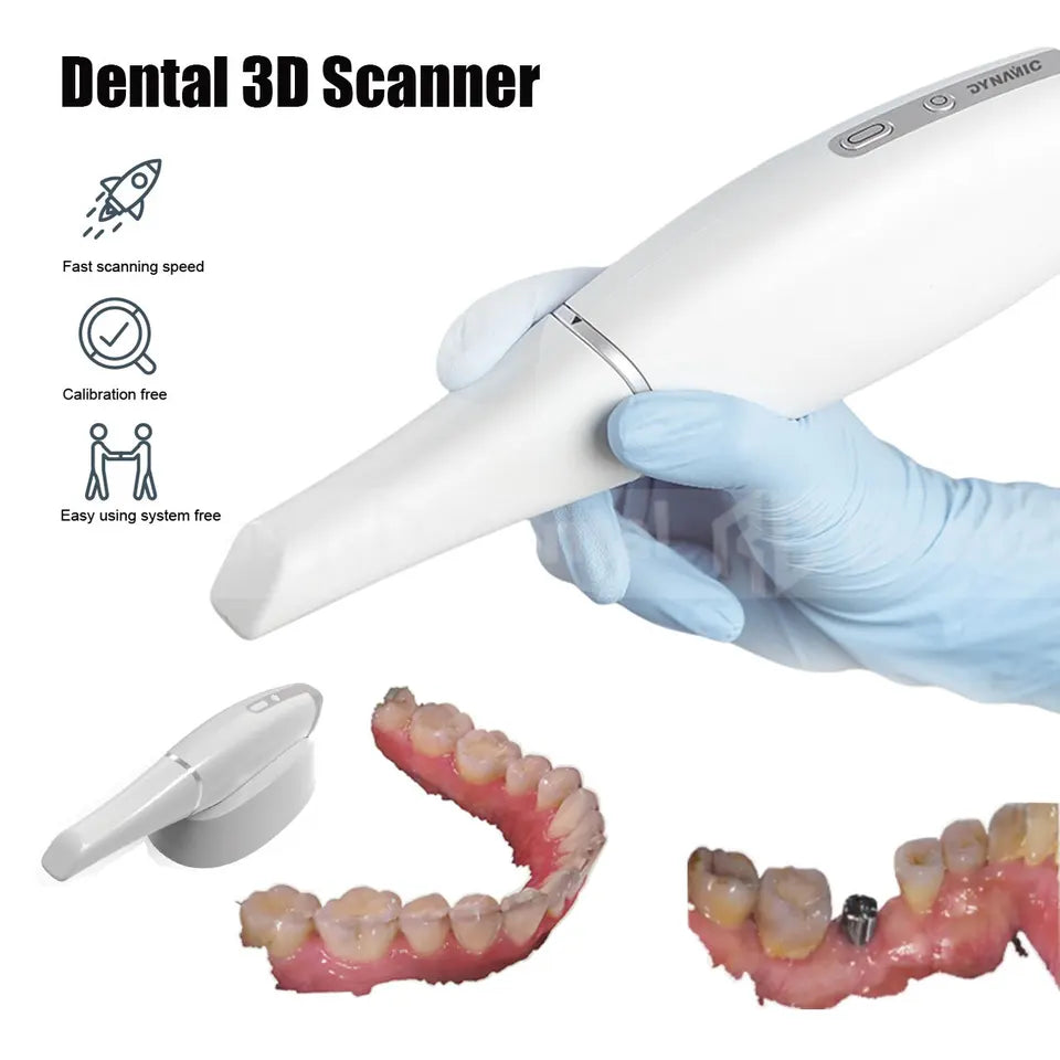 Digital Intraoral Dental Sensor Scanner - 3D Scanner with Software ...