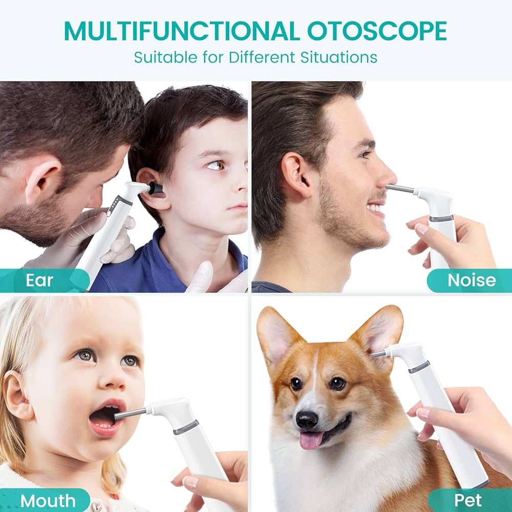 Digital Wireless Ear Otoscope 1080P HD Supplier Pakistan – BRIGHT WAY ...