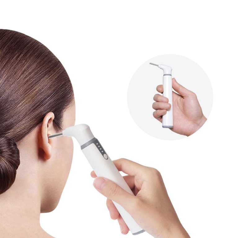 Digital Wireless Ear Otoscope 1080P HD Supplier Pakistan – BRIGHT WAY ...