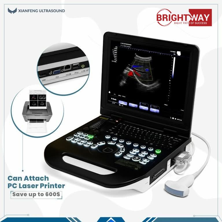 Best E30 Color Doppler Notebook Ultrasound Machine Supplier in Pakista ...