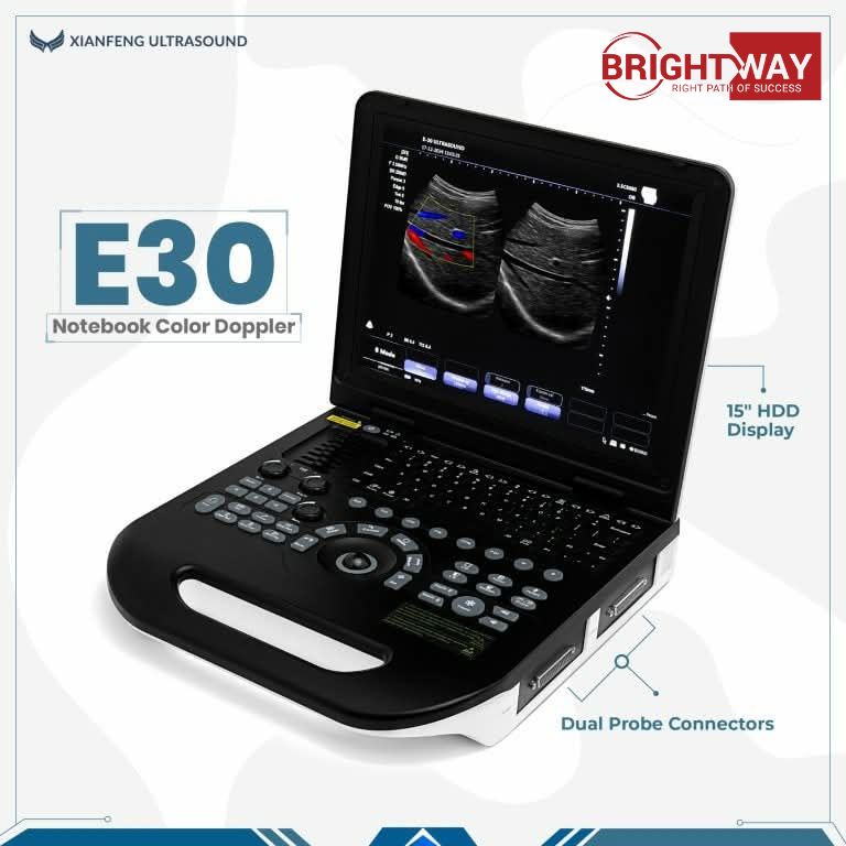 Best E30 Color Doppler Notebook Ultrasound Machine Supplier in Pakista ...