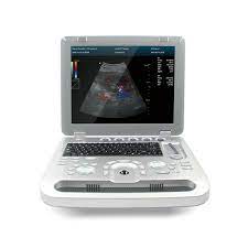 CONTEC CMS1700A Color Power Doppler Ultrasound Scanner Laptop Machine ...